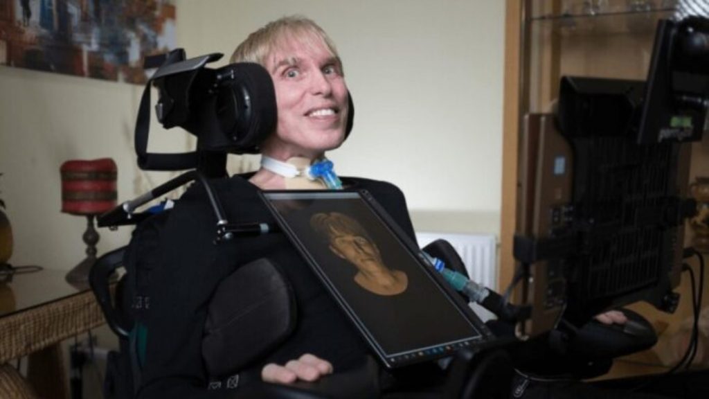 Fallece “el primer ciborg” del mundo Peter Scott-Morgan – Diario Basta!